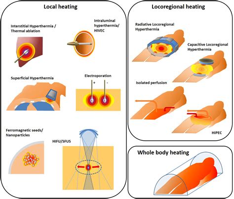 Heating Technology For Malignant Tumors A Review Pmc