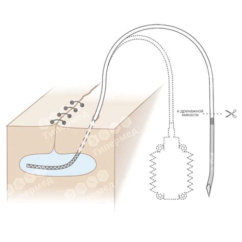 Трубка дренажная силиконовая плоская с перфорацией 7 10 мм оптом по выгодной цене Оптовый