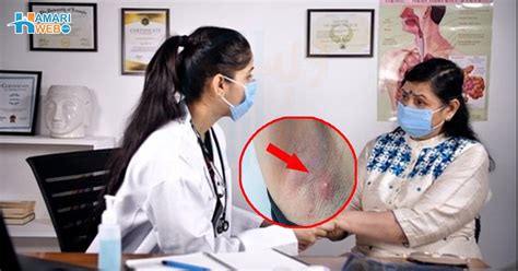 Armpit Pimple Causes In Urdu Women Health And Fitness
