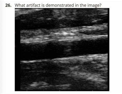 SPI Mock Registry Exam B20 Flashcards Quizlet