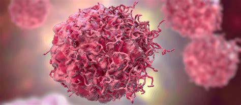 Neoplasm Vs Cancer Understanding The Difference Benign Vs Malignant Tumors