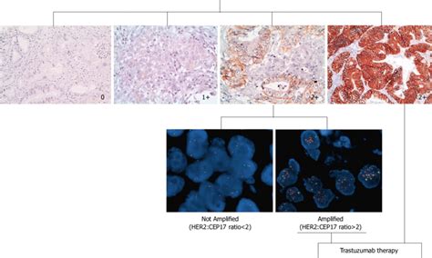 Diagnostic Algorithm For Her2 Status Evaluation In Gastric And