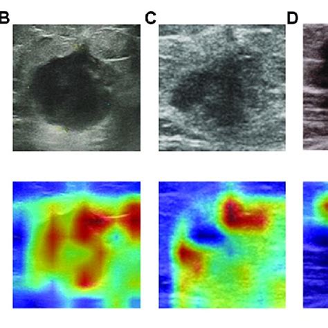 Heatmaps Generated By Grad Cam The Color Ranges From Blue To Red Download Scientific