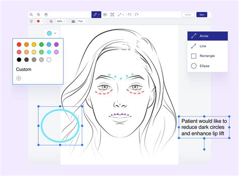Meet Image Markup A Powerful New Addition To Integrated Forms
