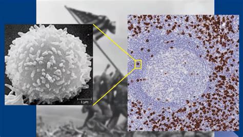 A New Cancer Therapy At Providence Helps Immune Cells Stand Their Ground