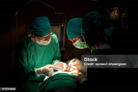 수술실의 팀 의사는 녹색 유니폼을 입고 생명을 구하는 중환자 심장 환자를 위해 심장 수술을받는 표준화 된 수술 도구 인명 구조 도구 등 심장 펌프 4 명에 대한 스톡 사진