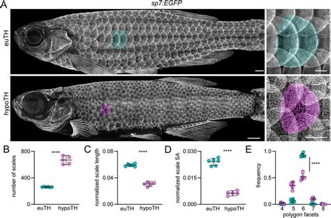 Thyroid Hormone Is Necessary For Normal Squamation A Dermal