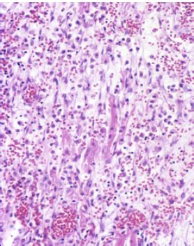 Cell Pathology Flashcards Quizlet