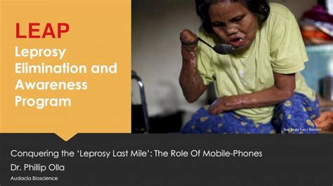 Pdf Leprosy Elimination And Awareness Program · Leprosy Elimination Challenges Poor Access To