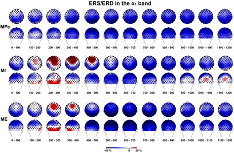 Topographies Of Event Related Synchronization Ers Red And Download Scientific Diagram