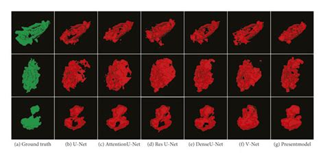 3d Reconstruction Of The Segmentation Results For Three Test Cases By
