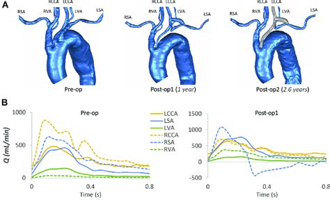Boundary Conditions For Computational Fluid Dynamics Cfd Simulations