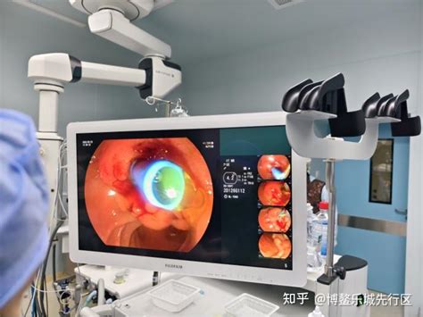 上海瑞金专家在乐城丨经内镜逆行性胆胰管造影术（ercp）惠及胆胰疾病患者 知乎