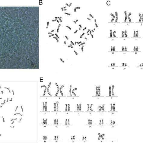 Morphology Of Placental Chorionic Cells And G Banded Karyotypes A Download Scientific Diagram