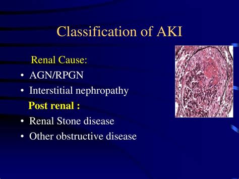 Ppt Update In The Management Of Aki Powerpoint Presentation Free Download Id3372855