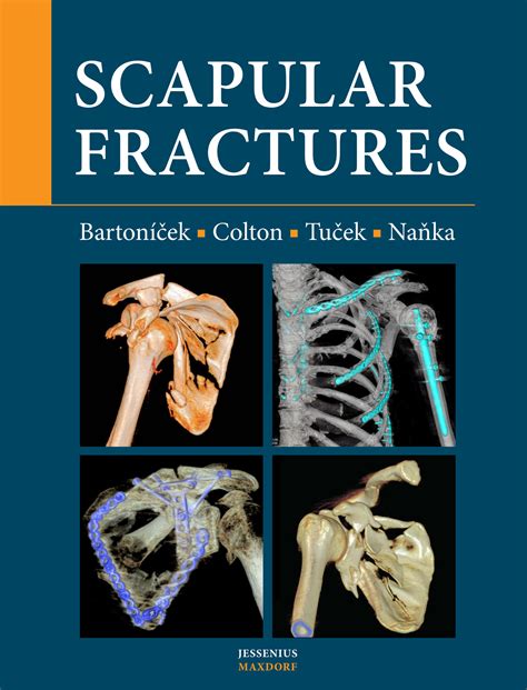 Scapular Fractures