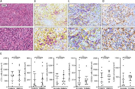 Figure 1 From Bright Field Multiplex Immunohistochemistry Assay For Tumor Microenvironment