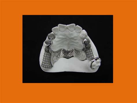 1659908partial Denture Classification Ppt