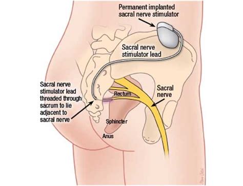 Sacral Nerve Anatomy