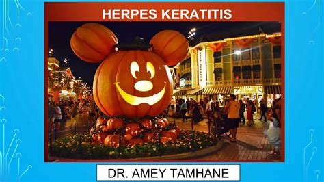 Herpes Simplex Keratitis Pptx Eye And Vision Conditions Diseases And Conditions