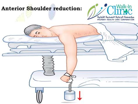 Limb Injuries Upper And Lower Limbs Pptx