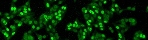 Task 1 Cell Level Staining Pattern Classification Hep 2 Contest