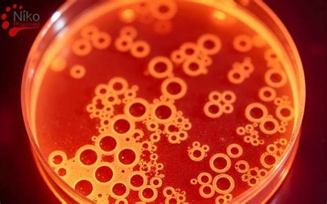 Kirby Bauer Disk Diffusion Testing Method