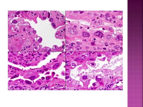 Endometrium Pathology Pptx Pregnancy Reproductive Health
