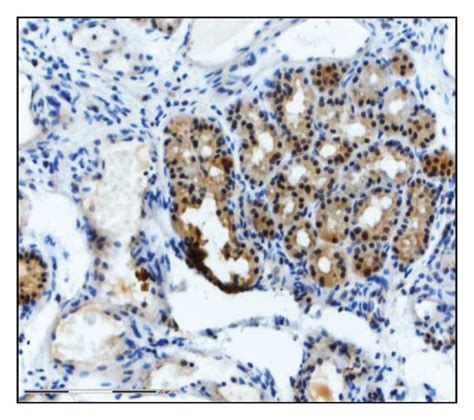 Immunohistochemistry On Formalin Fixed Paraffin Embedded Tissue Section Download Scientific