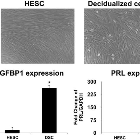 In Vitro Model Of Decidualization A Human Endometrial Stromal Cell Download Scientific Diagram