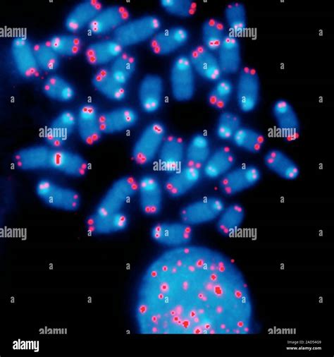 Chromosome Telomeres Fluorescence Light Micrograph Of Human Chromosomes With The Ends Of The