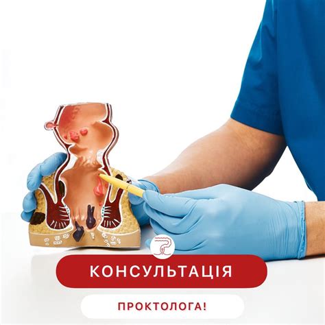 Консультація проктолога — Медичний центр Integro Plus в Черкасах