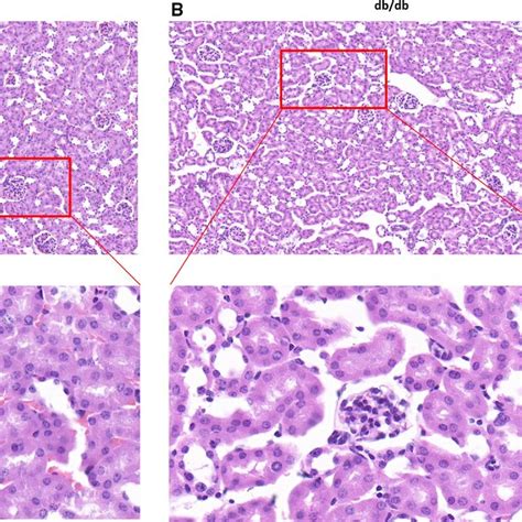increased renal fibrosis and downregulation of circeif4g2 in db db mice
