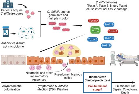 Fulminant Clostridioides Difficile Infection Medical Clinics
