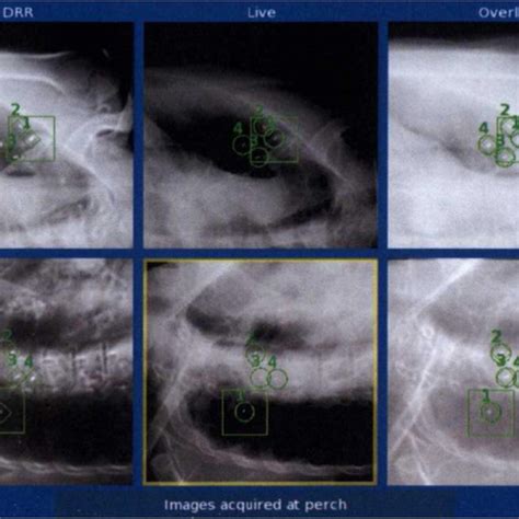 Fiducial Placement Guidance System Example A Screenshot From The Fpgs Download Scientific