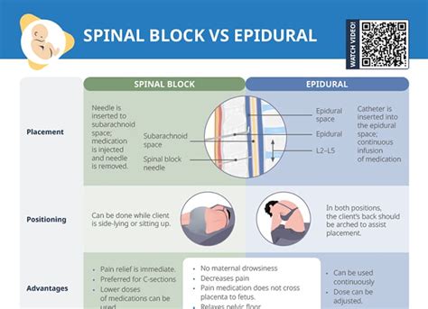 Spinal Block Vs Epidural Free Cheat Sheet Lecturio