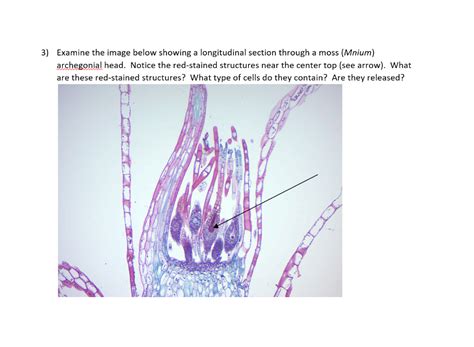 Moss Archegonial Head