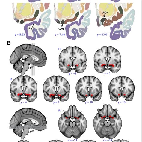 Parcellation Of Primary Olfactory Cortex Combined Across Left And Right Download Scientific