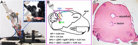 Video Elimination Of Serotonergic Neurons By Stereotaxic Injection Of 5 7 Dihydroxytryptamine