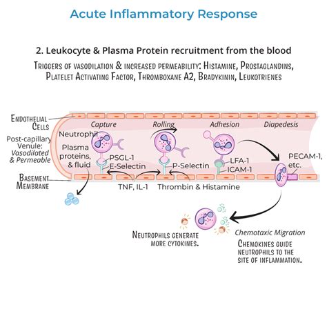 Clinical Pathology Glossary Acute Inflammatory Response Ditki
