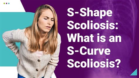 S Shape Scoliosis What Is An S Curve Scoliosis Youtube