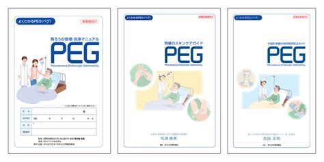 Peg関連情報 処置具 消化器内科 オリンパス医療ウェブサイト