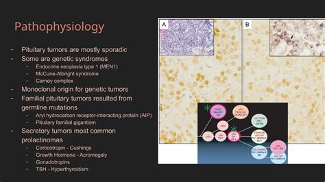 Secreting Pituitary Adenomaspresent Pptx