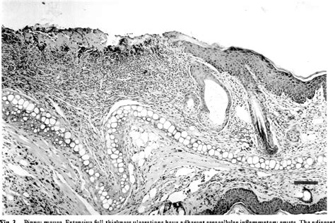 Myiasis Semantic Scholar
