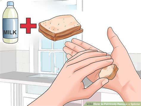 How To Painlessly Remove A Splinter Steps With Pictures
