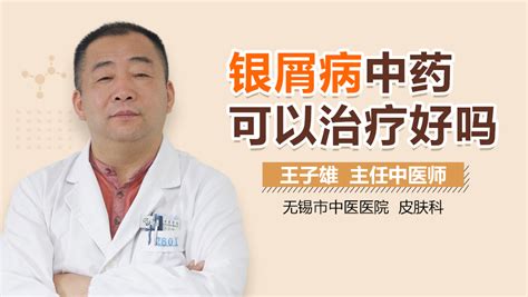 银屑病吃什么药好 治疗银屑病的中药有哪些中华康网