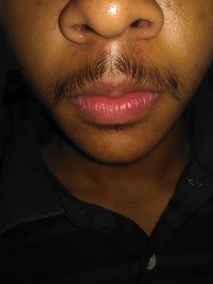 13 Year Old Babe Got A Small Beard Post 10 Beard Board