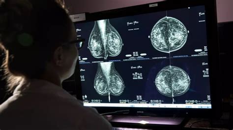 La Provincia Hará Mamografías Gratis Y Sin Turno Previo En 20 Hospitales Para Prevenir El Cáncer