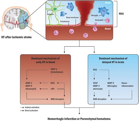 Frontiers Hemorrhagic Transformation After Ischemic Stroke
