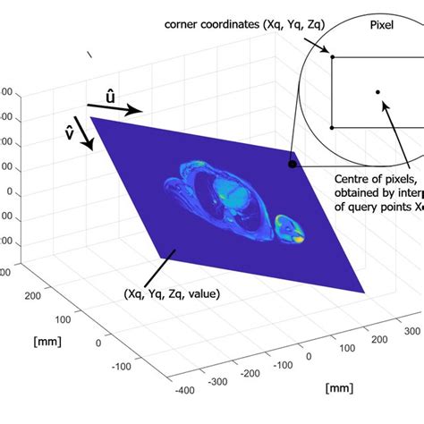 Pdf Coil Sensitivity Estimation And Intensity Normalisation For